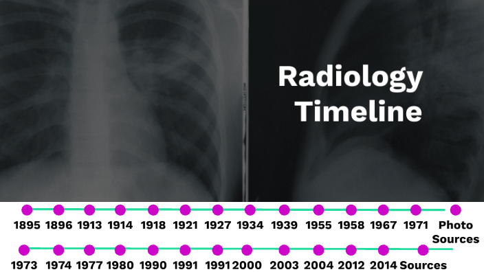Radiology Timeline by maddie holt on Prezi