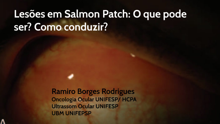 Salmon Patch by Ramiro Borges Rodrigues on Prezi