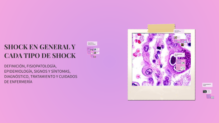 SHOCK EN GENERAL Y CADA TIPO DE SHOCK by Kelly Ospina Colorado on Prezi