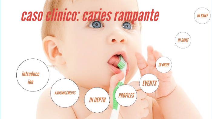 Caso clínico : Caries Rampante by SE Bas on Prezi