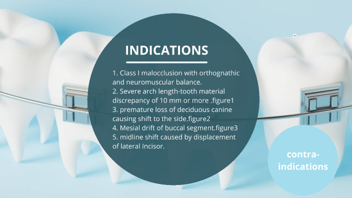 serial extraction in orthodontics by zainab wahab on Prezi