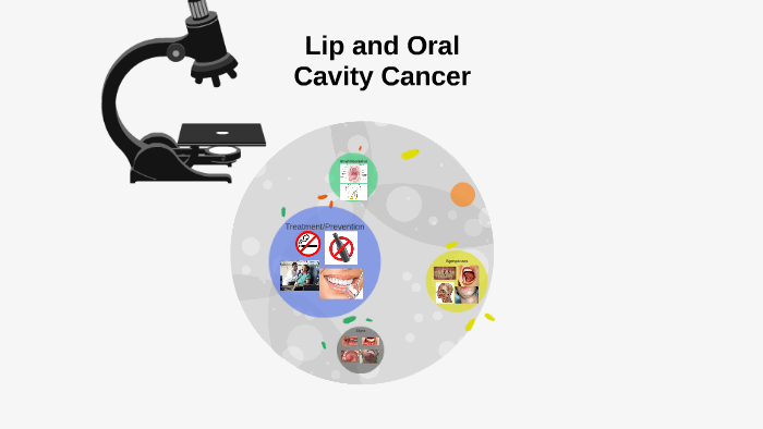 Lip and Oral Cavity Cancer by Pooja Lal