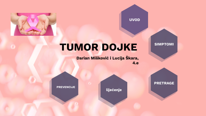 TUMOR DOJKE by lucija škara on Prezi