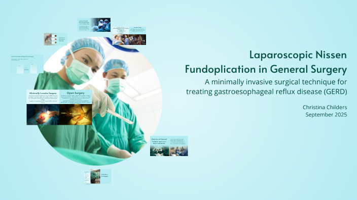 Laparoscopic Nissen Fundoplication in General Surgery by Christina ...