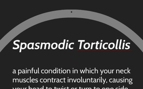 Spasmodic Torticollis by Adam Archbold on Prezi