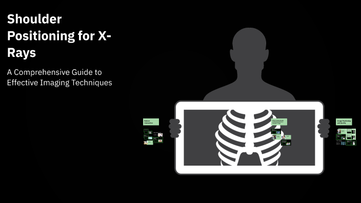 Shoulder Positioning for X-Rays by Emony Bell on Prezi