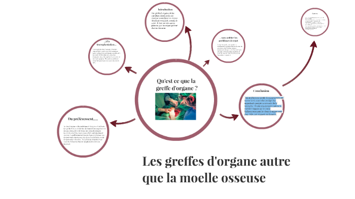 Qu'est ce que la greffe d'organe ? by matthieu Meignin on Prezi