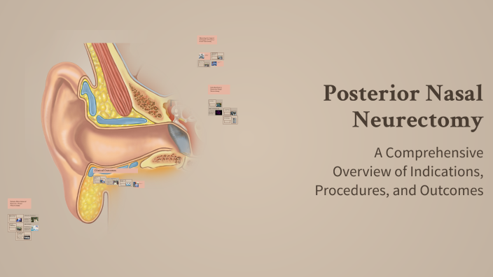 Posterior Nasal Neurectomy by wamiq ali on Prezi
