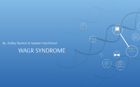 WAGR SYNDROME by Ashley Harmon on Prezi