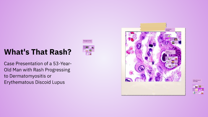 What's That Rash? by Sara-Lynn Pelegrin on Prezi
