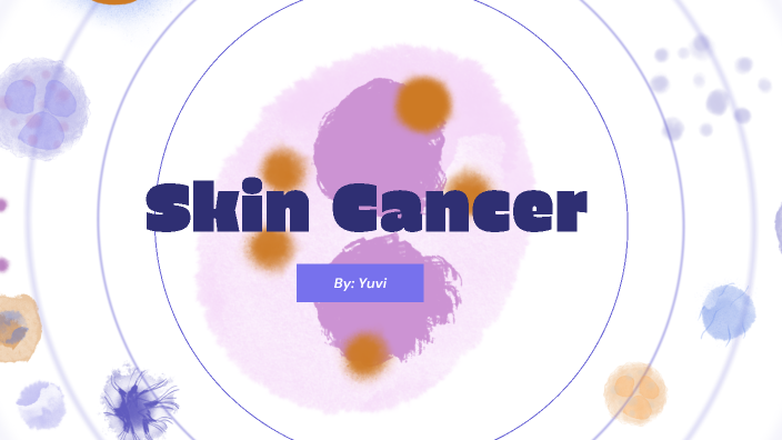 Yuvi H- Skin Cancer by Yuvi Hailemichael on Prezi