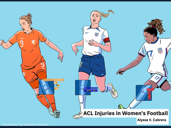 ACL Injuries in Women's Soccer by Alyssa Cabrera on Prezi