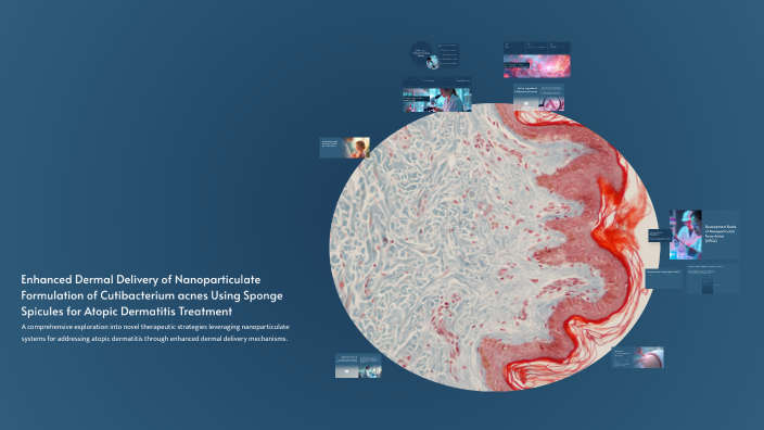 Enhanced Dermal Delivery of Nanoparticulate Formulation of ...