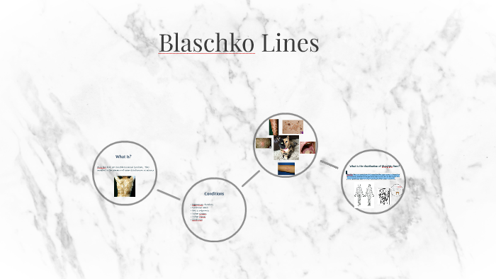Blaschko Lines by Valery Aponte on Prezi