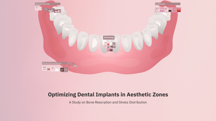 Optimizing Dental Implants in Aesthetic Zones by Maniesha Bhagwandat on ...