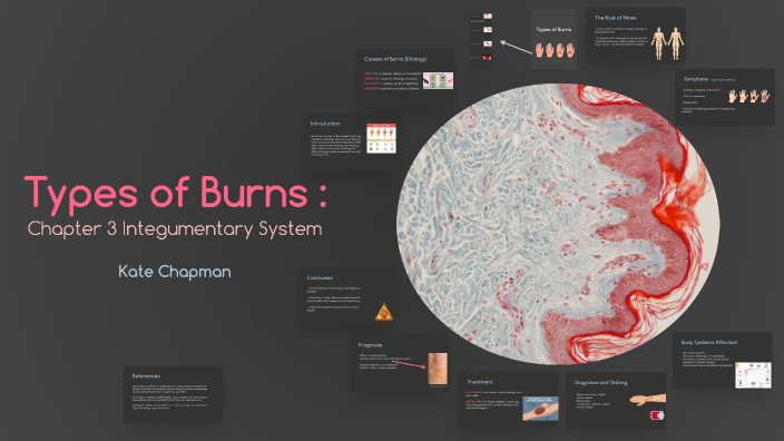 Burns and Skin Healing: Understanding the Integumentary System by Kate ...