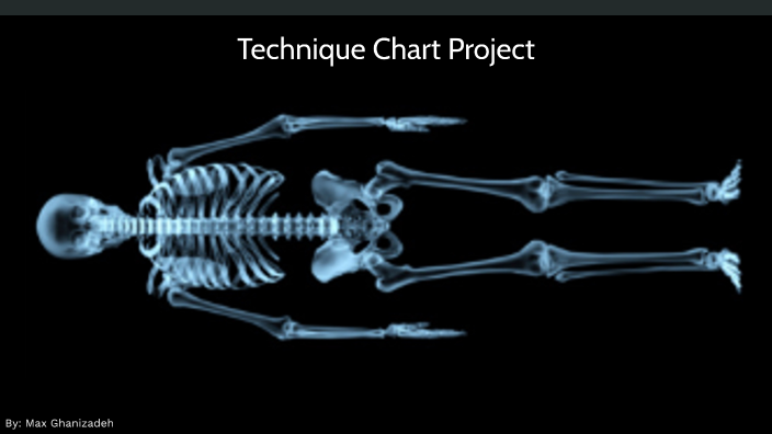 Radiation Technique Chart by Max