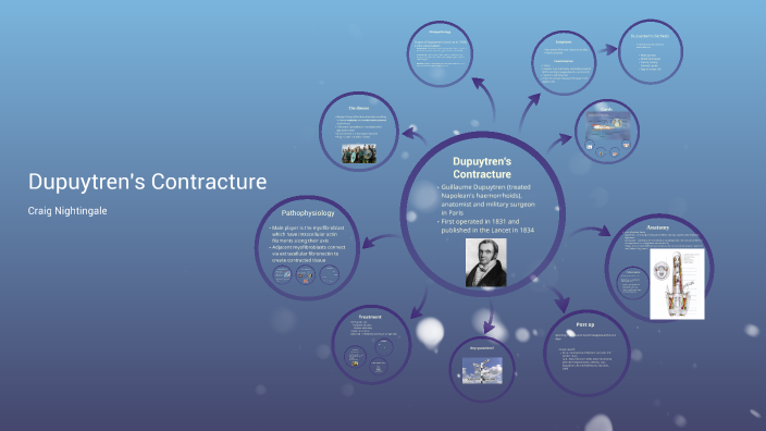 Dupuytrens by Craig Nightingale on Prezi
