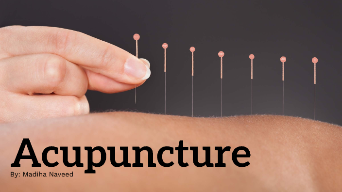 Alternative & Holistic Modalities Assignment - Acupuncture by Huba Naveed on Prezi