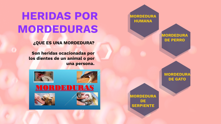 Heridas por mordeduras by Lisbeth Danicsa Torres Palacios on Prezi