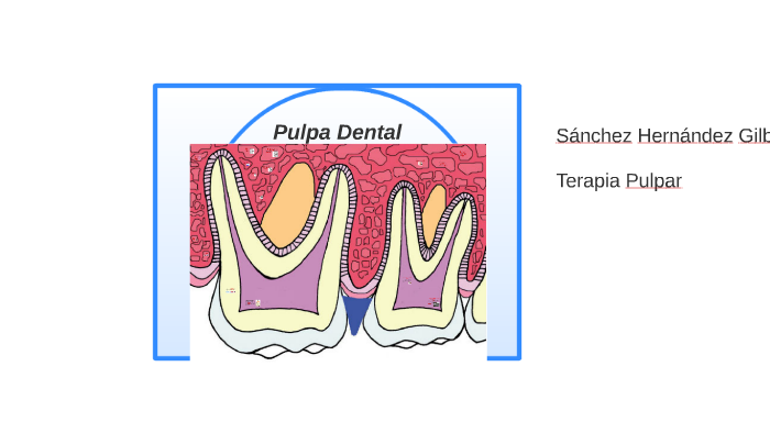 Pulpa Dental by Gil Sanchez Hdz on Prezi