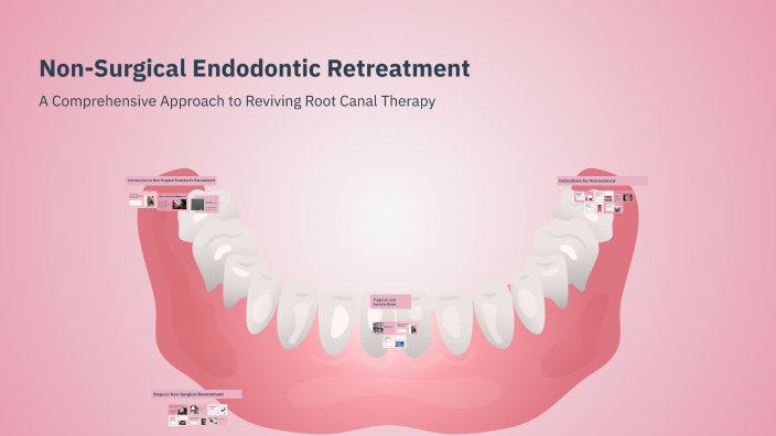 Non-Surgical Endodontic Retreatment by Mohamed Madi on Prezi