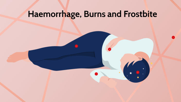 Classification and treatment of wounds + frostbite + burns by Rebecka ...