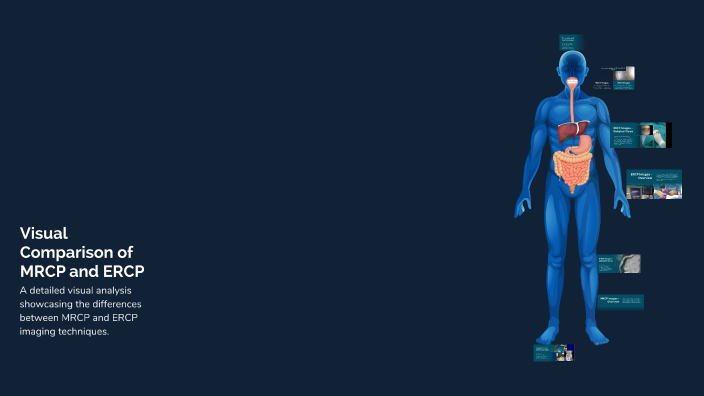 Visual Comparison of MRCP and ERCP by Kakashi Hatake on Prezi