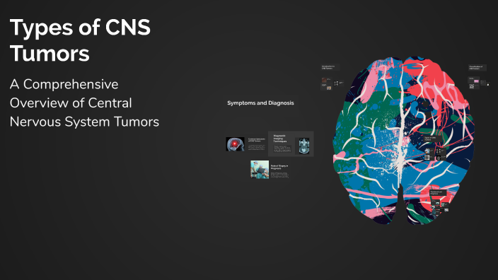 Types of CNS Tumors by abdulrahman naser on Prezi