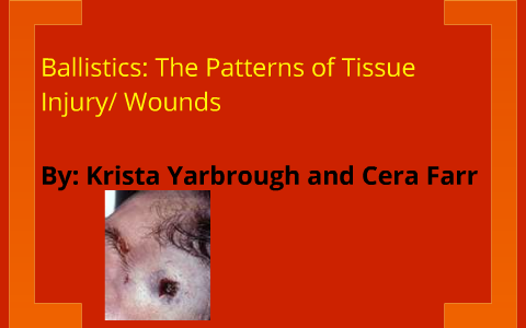 ballistics / patterns of tissue injury by cera farr on Prezi