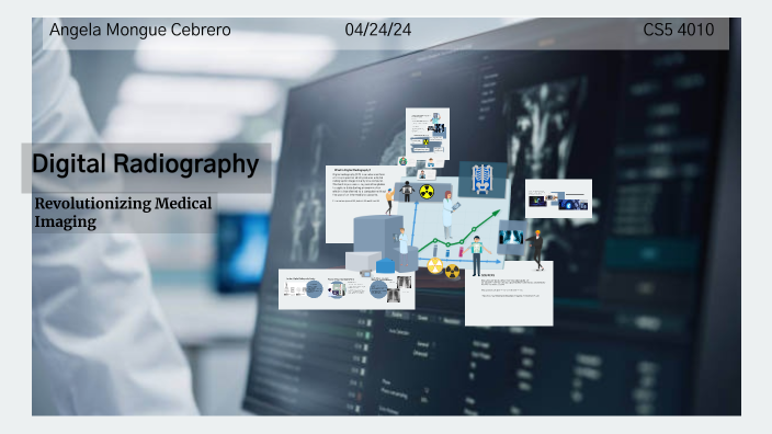 Digital Radiography vs Traditional Radiography by Angela Cebrero on Prezi
