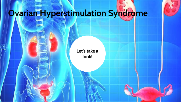 Ovarian Hyperstimulation by Jeremy Stephan on Prezi