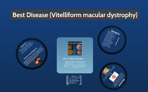 Best Disease (Vitelliform macular dystrophy) by Juan Sanchez on Prezi