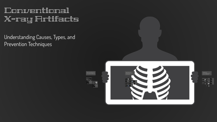 Conventional X-ray Artifacts by Hussein Mohammed Ali on Prezi
