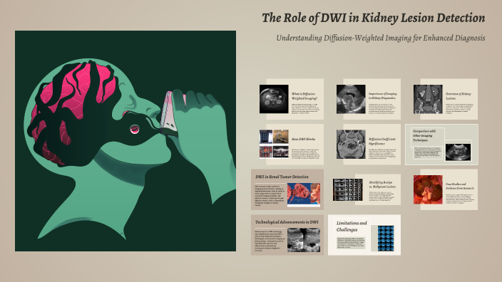 The role of DWI in kidney lesion detection by Katelynd Gwilliam on Prezi