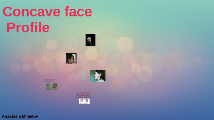 Concave face Profile by Anastasia Mihailov on Prezi