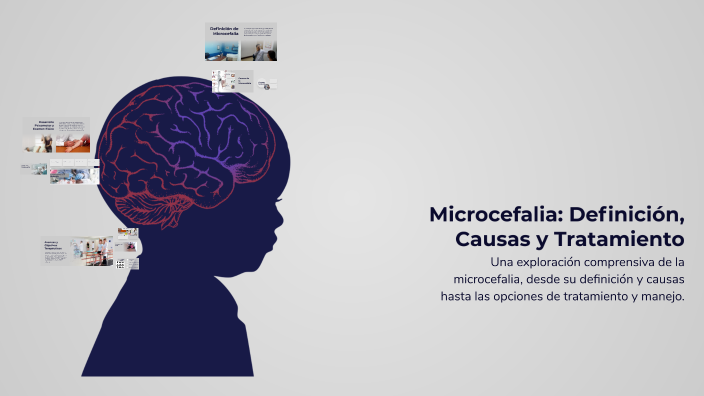 Microcefalia: Definición, Causas y Tratamiento by sofia obispo on Prezi