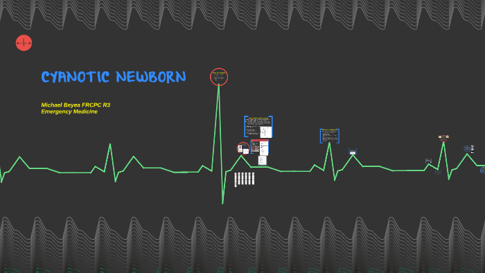CYANOTIC NEWBORN by Michael Beyea on Prezi