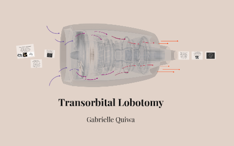 Transorbital Lobotomy by Gabrielle Quiwa on Prezi