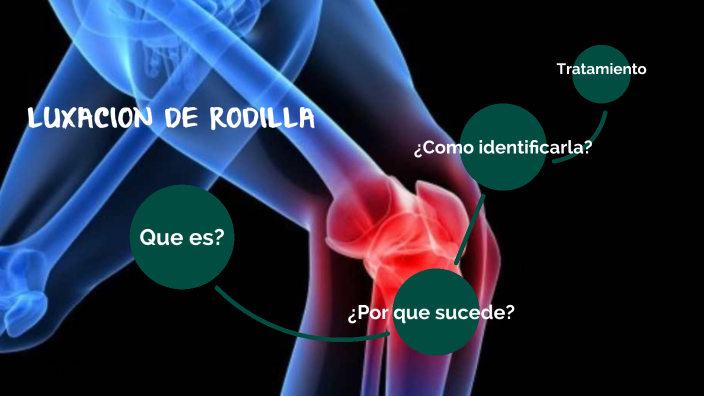 Luxación de rodilla by darling lorena espinosa ayobi on Prezi