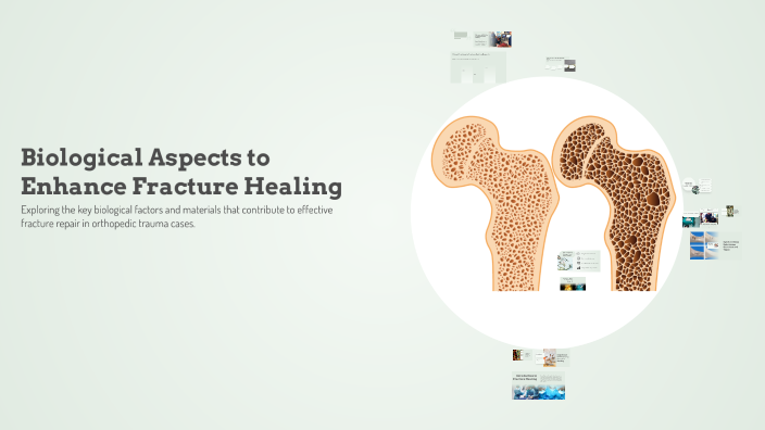 Biological Aspects to Enhance Fracture Healing by Snehal Sonani on Prezi