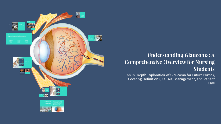 Understanding Glaucoma: A Comprehensive Overview for Nursing Students ...