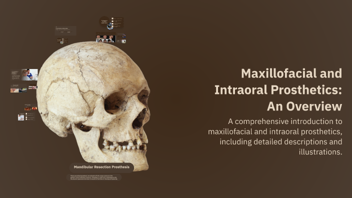 Maxillofacial and Intraoral Prosthetics: An Overview by د.رشاد العامري ...