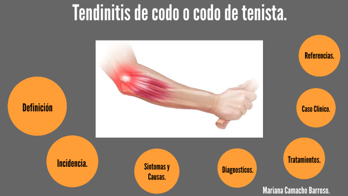 Tendinitis de codo. by Mariana Camacho Barroso on Prezi