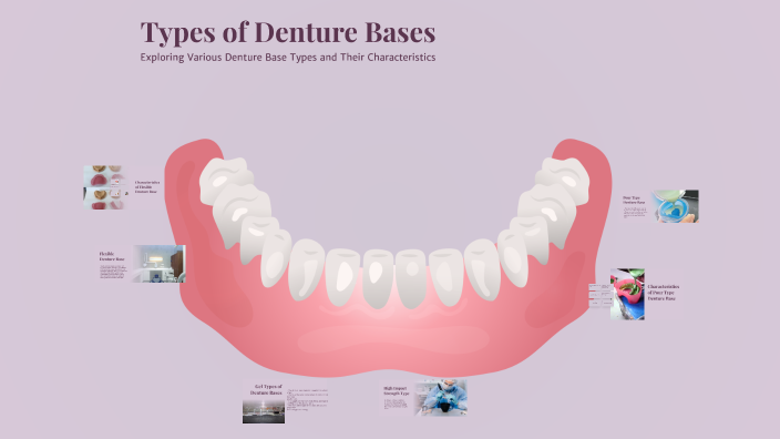 Types of Denture Bases by Abdo Elnagar on Prezi