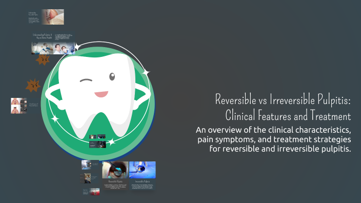 Reversible vs Irreversible Pulpitis: Clinical Features and Treatment by ...