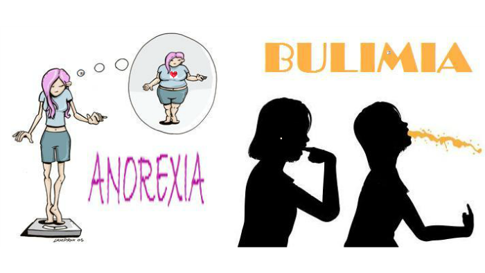 ¿Qué es la anorexia? by jessica morejon