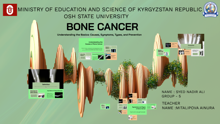 BONE CANCER by NADIR ALI on Prezi