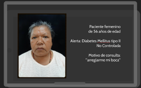 Paciente femenino de 56 años de edad by Jessica Licona on Prezi