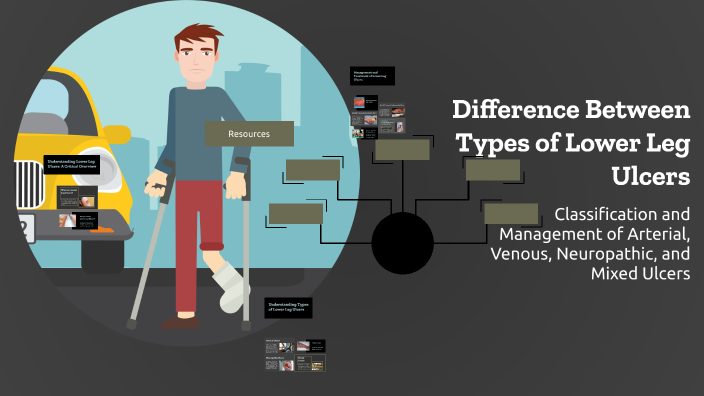 Difference Between Types of Lower Leg Ulcers by Evan Jones on Prezi